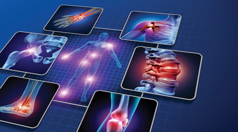 Everything You Need To Know About Sports Injuries – Even If You Aren't ...